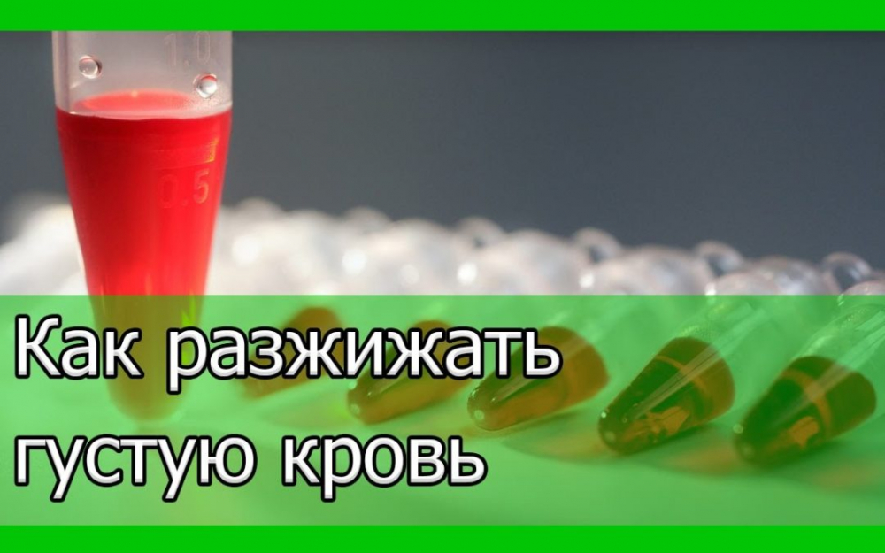Густая кровь: причины и лечение - как разжижать и список самых ...